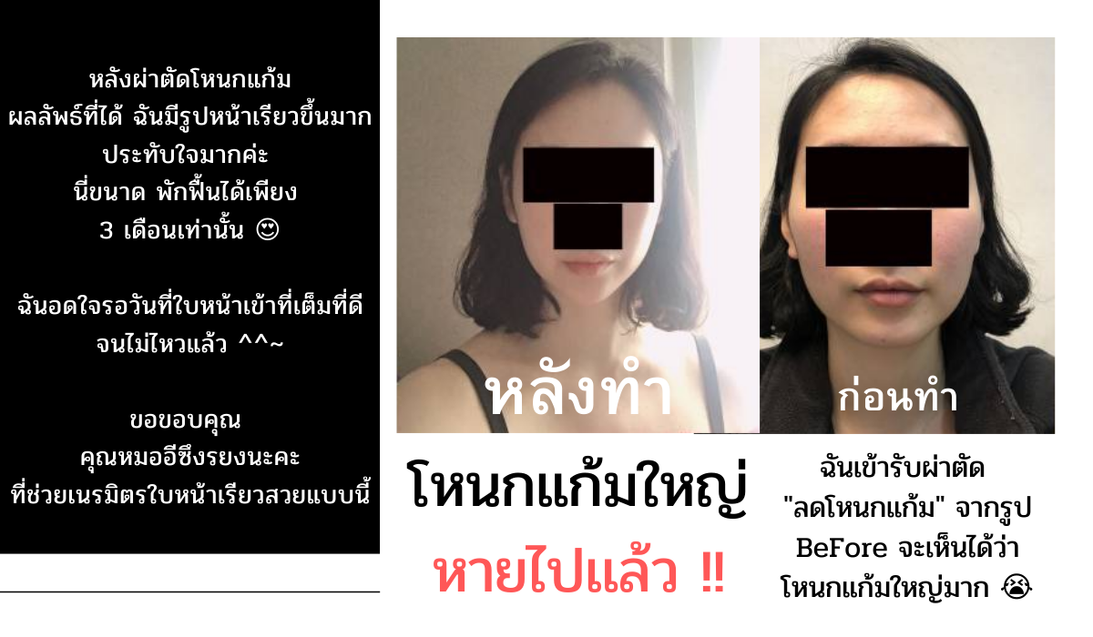 เอเจนซี่ศัลยกรรมเกาหลี เอริบิวตี้ (에리뷰티) - Ari Beauty